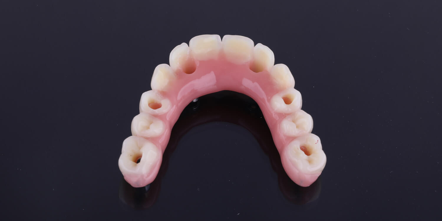 All on 4 en All on 6: alternatief voor een klikprothese - Blog ...